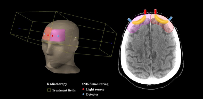 Measuring changes in brain tissue oxygenation for personalized cancer ...