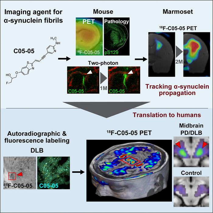 Visualizing core pathologies of Parkinson’s disease and related ...